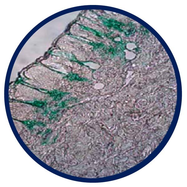 Microaiguillage DP4 - Obella esthétique de pointe